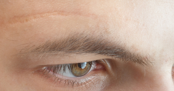 Wie entstehen Narben?